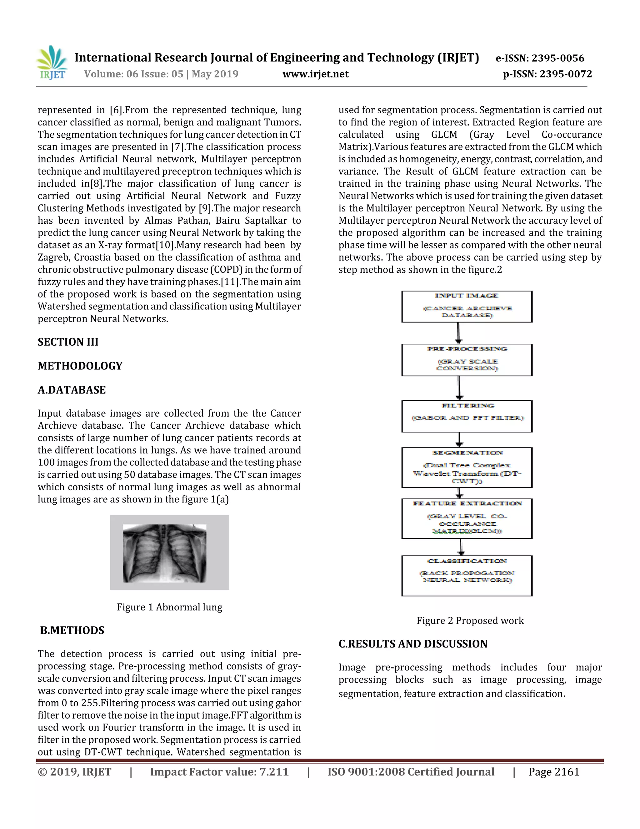 IRJET- Analysis of Lung Cancer using Multilayer Perceptron Classifier | PDF