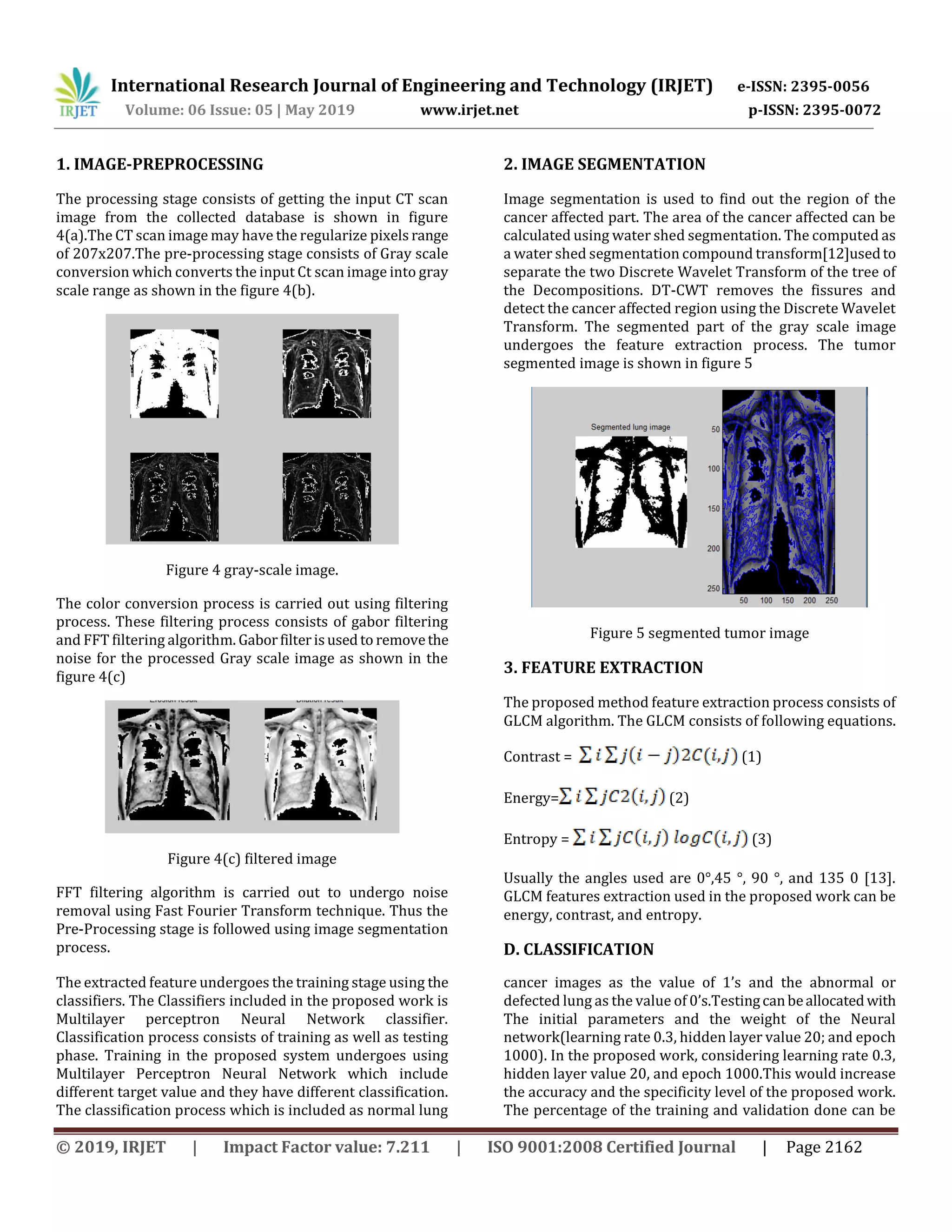 Irjet Analysis Of Lung Cancer Using Multilayer Perceptron Classifier Pdf