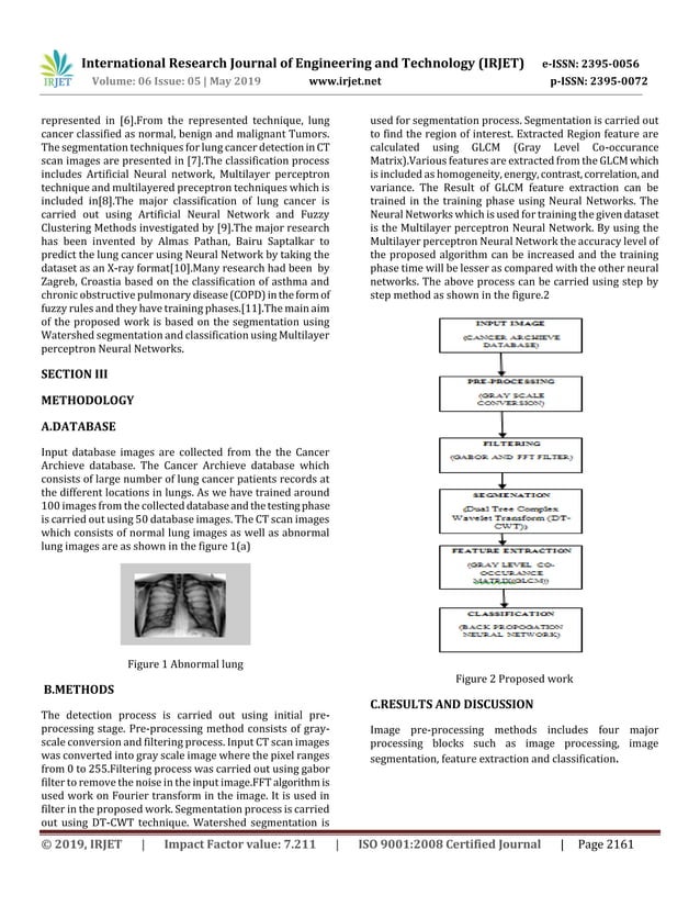IRJET- Analysis of Lung Cancer using Multilayer Perceptron Classifier | PDF