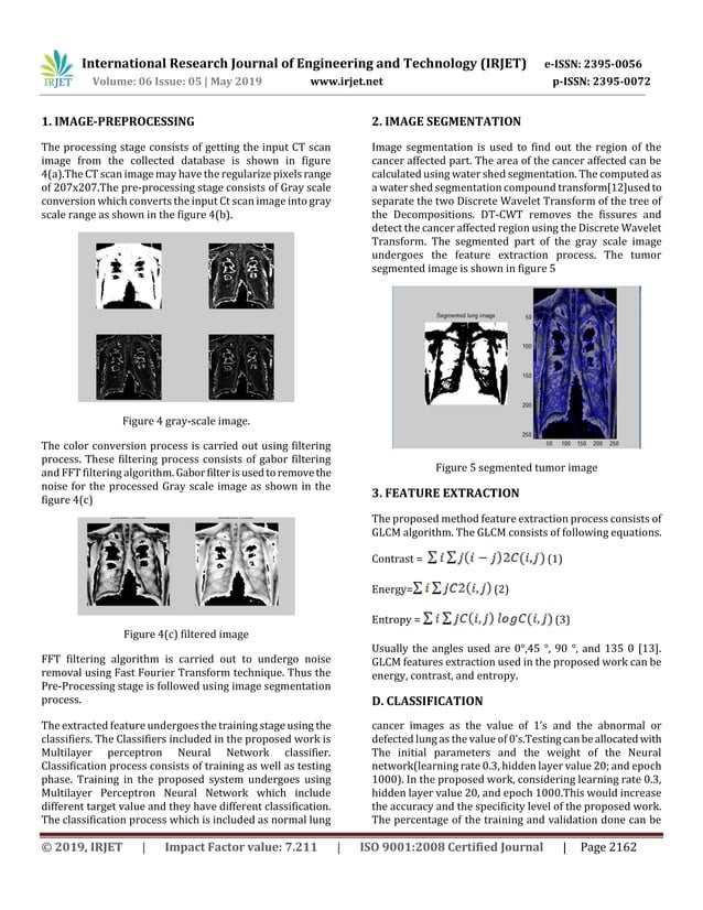 IRJET- Analysis of Lung Cancer using Multilayer Perceptron Classifier | PDF