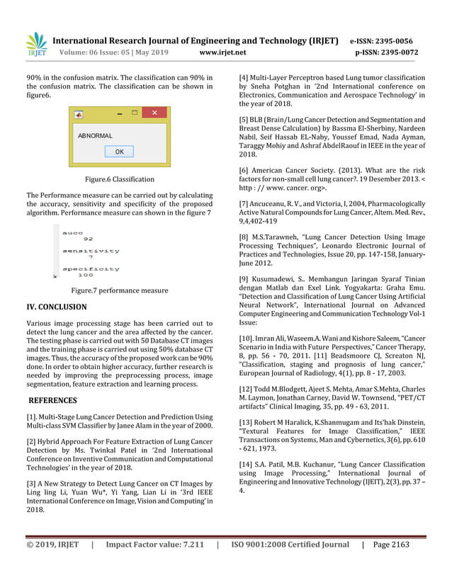 IRJET- Analysis of Lung Cancer using Multilayer Perceptron Classifier | PDF