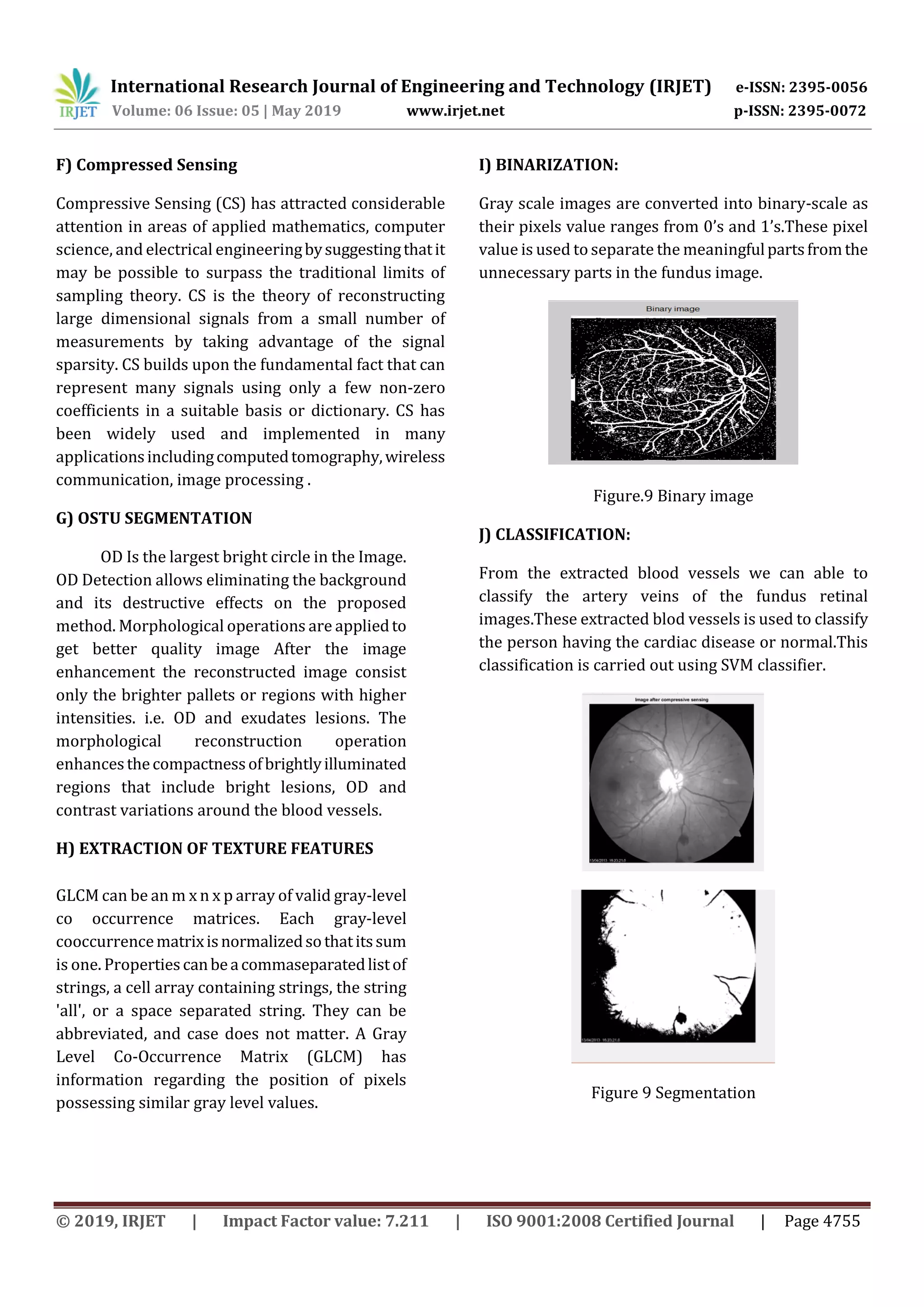 IRJET- Automated Detection of Diabetic Retinopathy using Compressed Sensing | PDF
