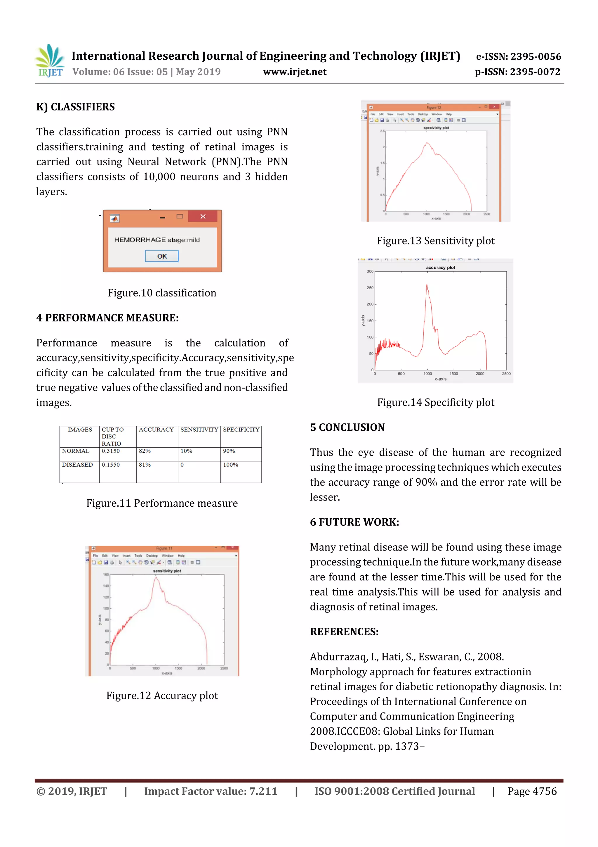 IRJET- Automated Detection of Diabetic Retinopathy using Compressed Sensing | PDF