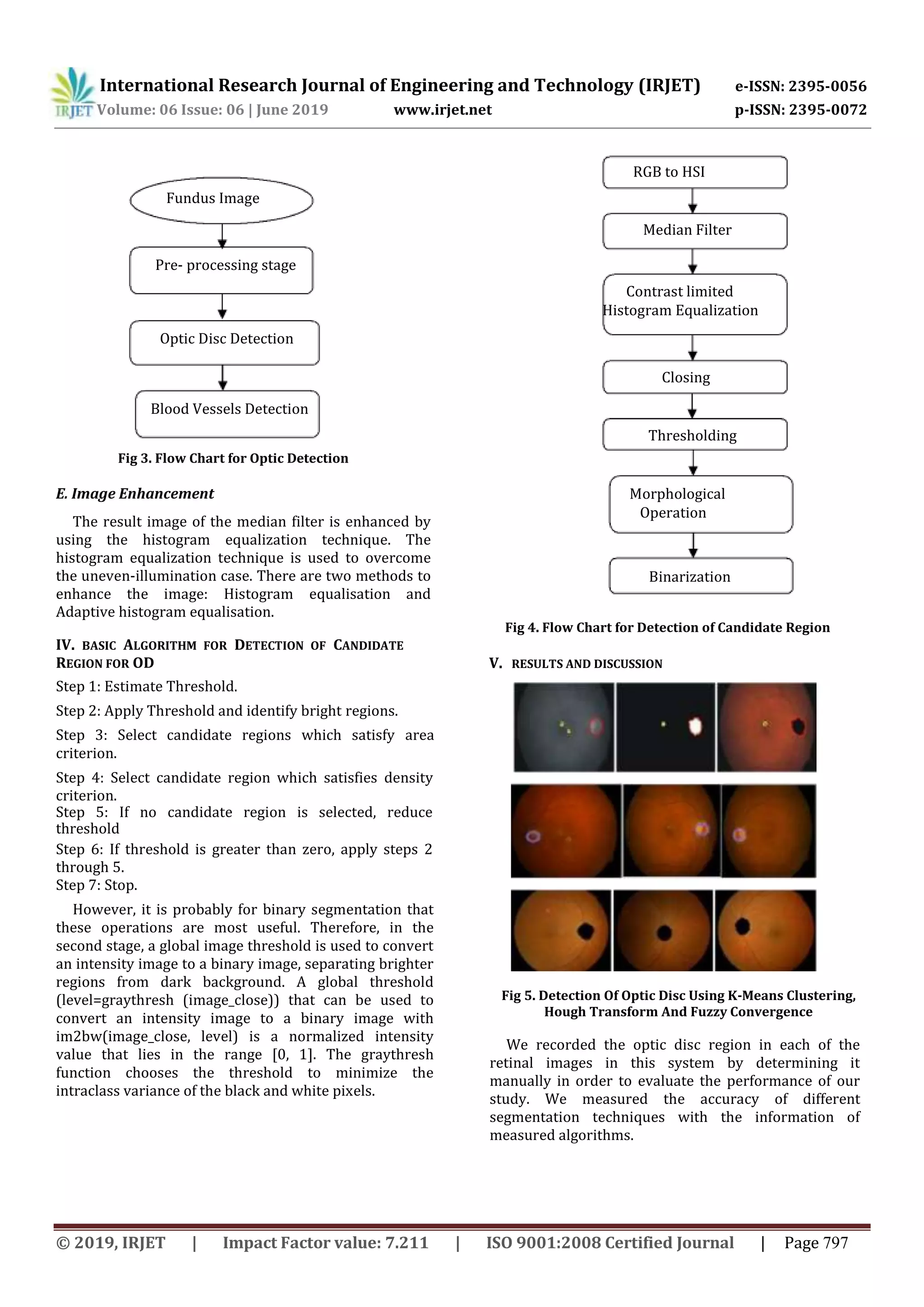 Irjet Survey Based On Detection Of Optic Disc In Retinal Images Using Segmentation Based