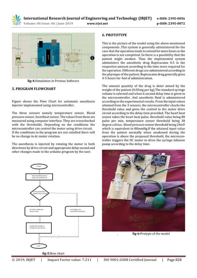 IRJET- Microcontroller based Anesthesia Injector | PDF