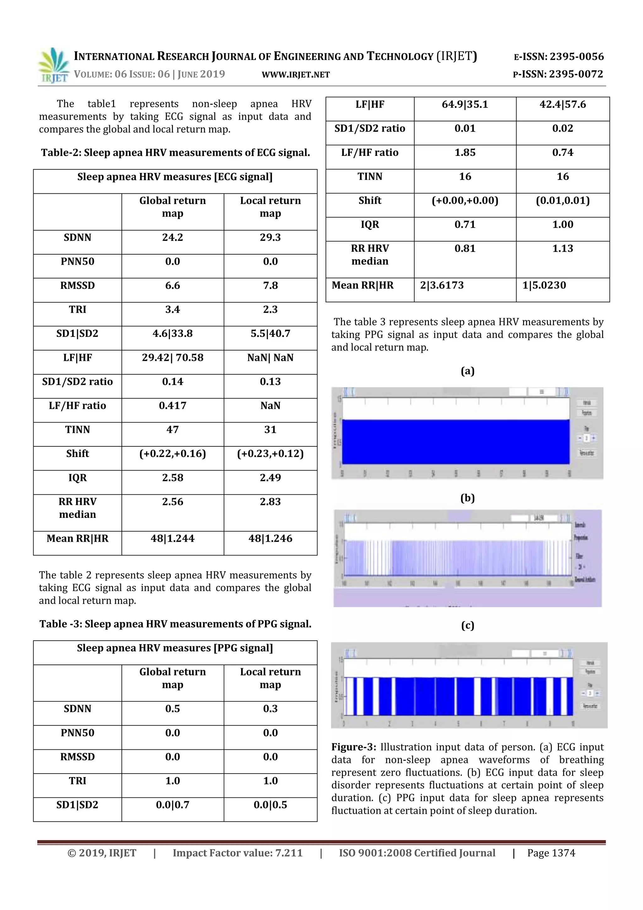 IRJET - Sleep Apnea Detection using Physiological Signals | PDF