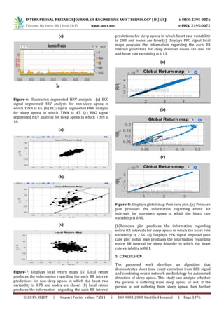IRJET - Sleep Apnea Detection using Physiological Signals | PDF