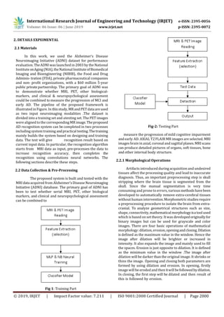 IRJET- Prediction of Alzheimer’s Disease with Deep Learning | PDF