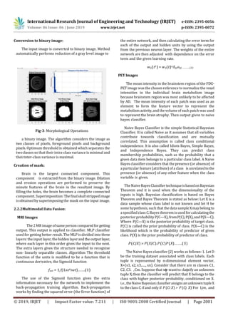IRJET- Prediction of Alzheimer’s Disease with Deep Learning | PDF