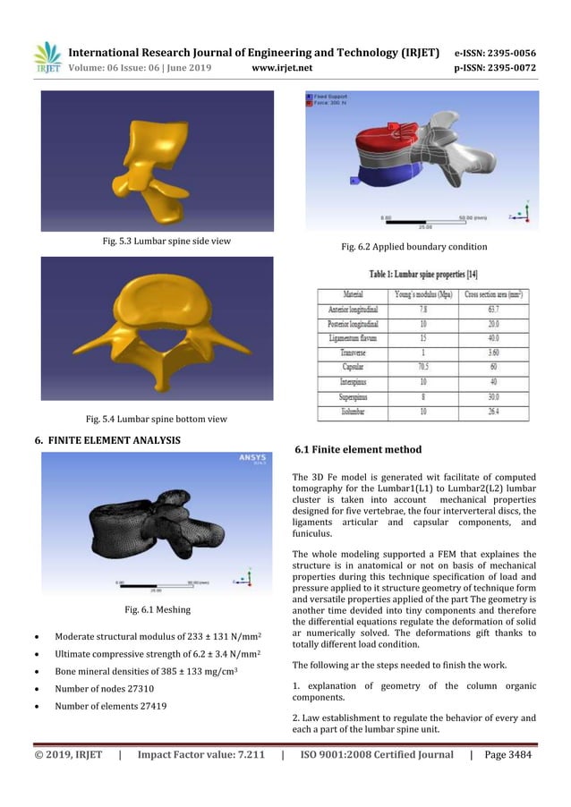 IRJET- Design and Analysis of Lumbar Spine using Finite Element Method | PDF