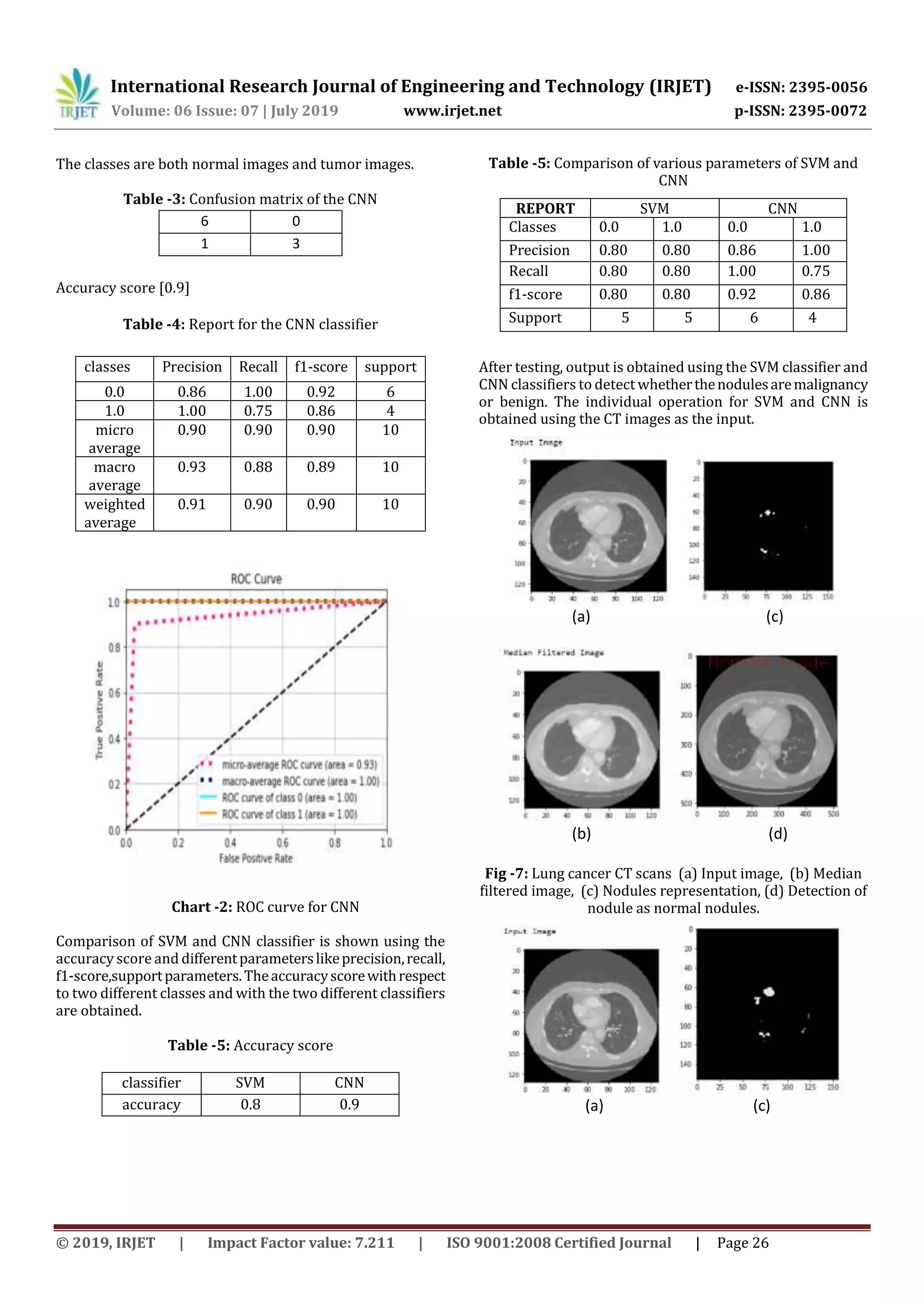 Irjet Lung Cancer Nodules Classification And Detection Using Svm And Cnn Classifiers Pdf