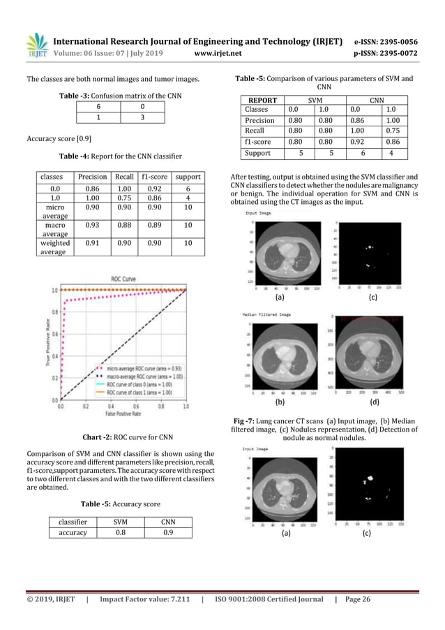 IRJET- Lung Cancer Nodules Classification and Detection using SVM and CNN Classifiers | PDF