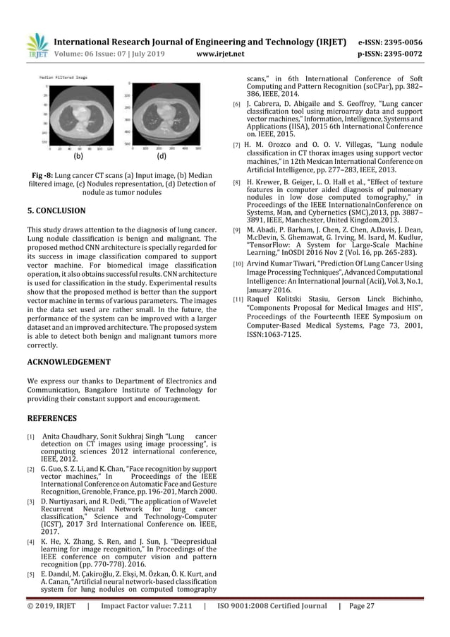 IRJET- Lung Cancer Nodules Classification and Detection using SVM and CNN Classifiers | PDF