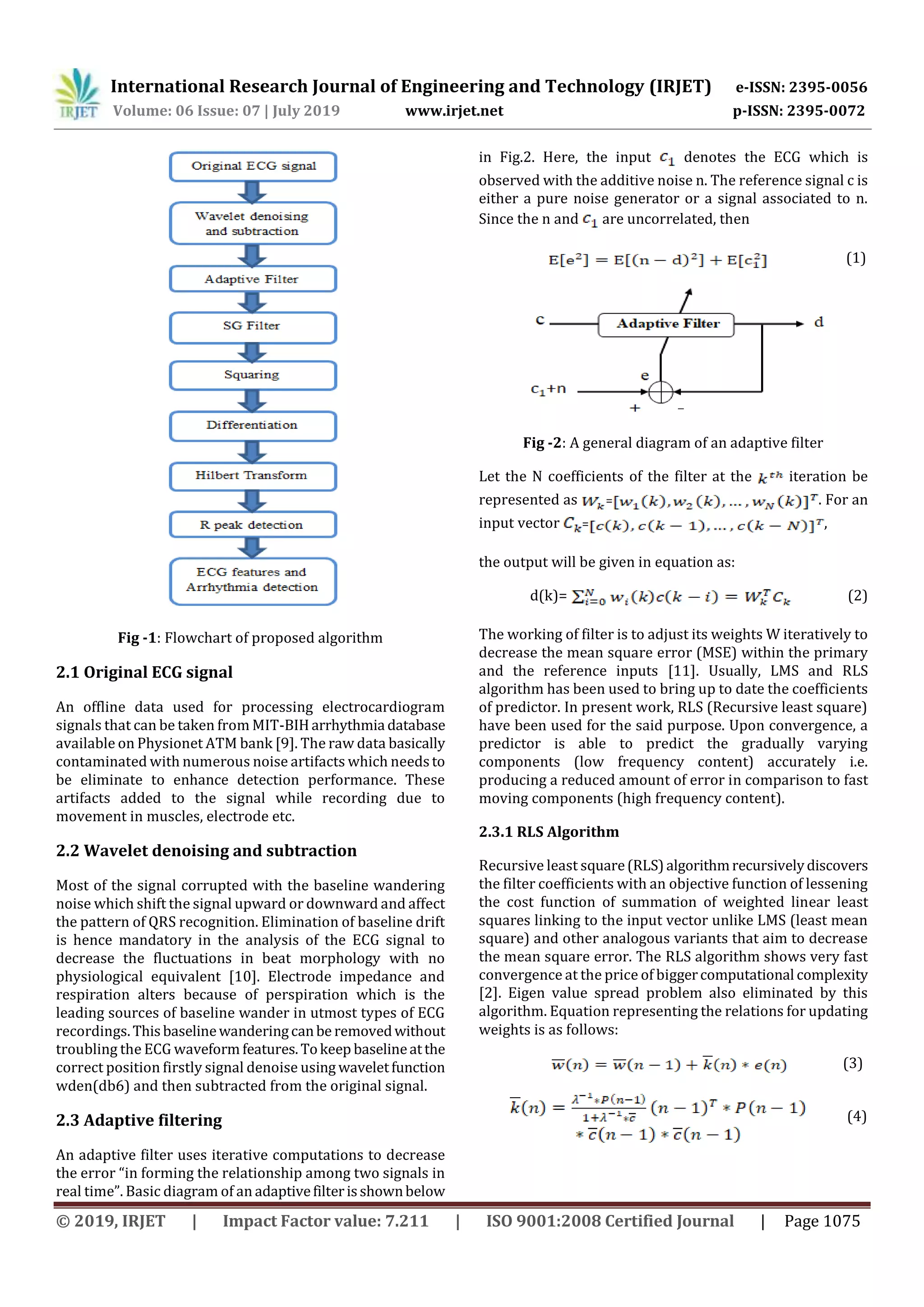 IRJET- R Peak Detection with Diagnosis of Arrhythmia using Adaptive Filter and Hilbert Transform ...