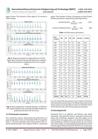 IRJET- R Peak Detection with Diagnosis of Arrhythmia using Adaptive Filter and Hilbert Transform ...