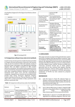 IRJET- R Peak Detection with Diagnosis of Arrhythmia using Adaptive Filter and Hilbert Transform ...