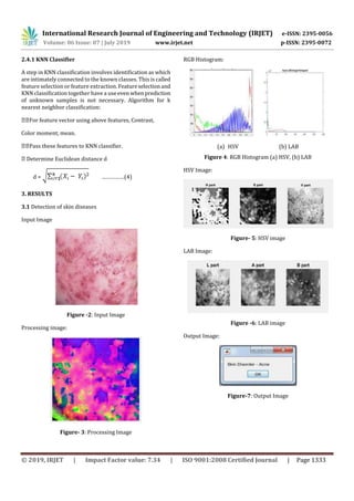 IRJET- Detection and Classification of Skin Diseases using Different Color Phase Models | PDF