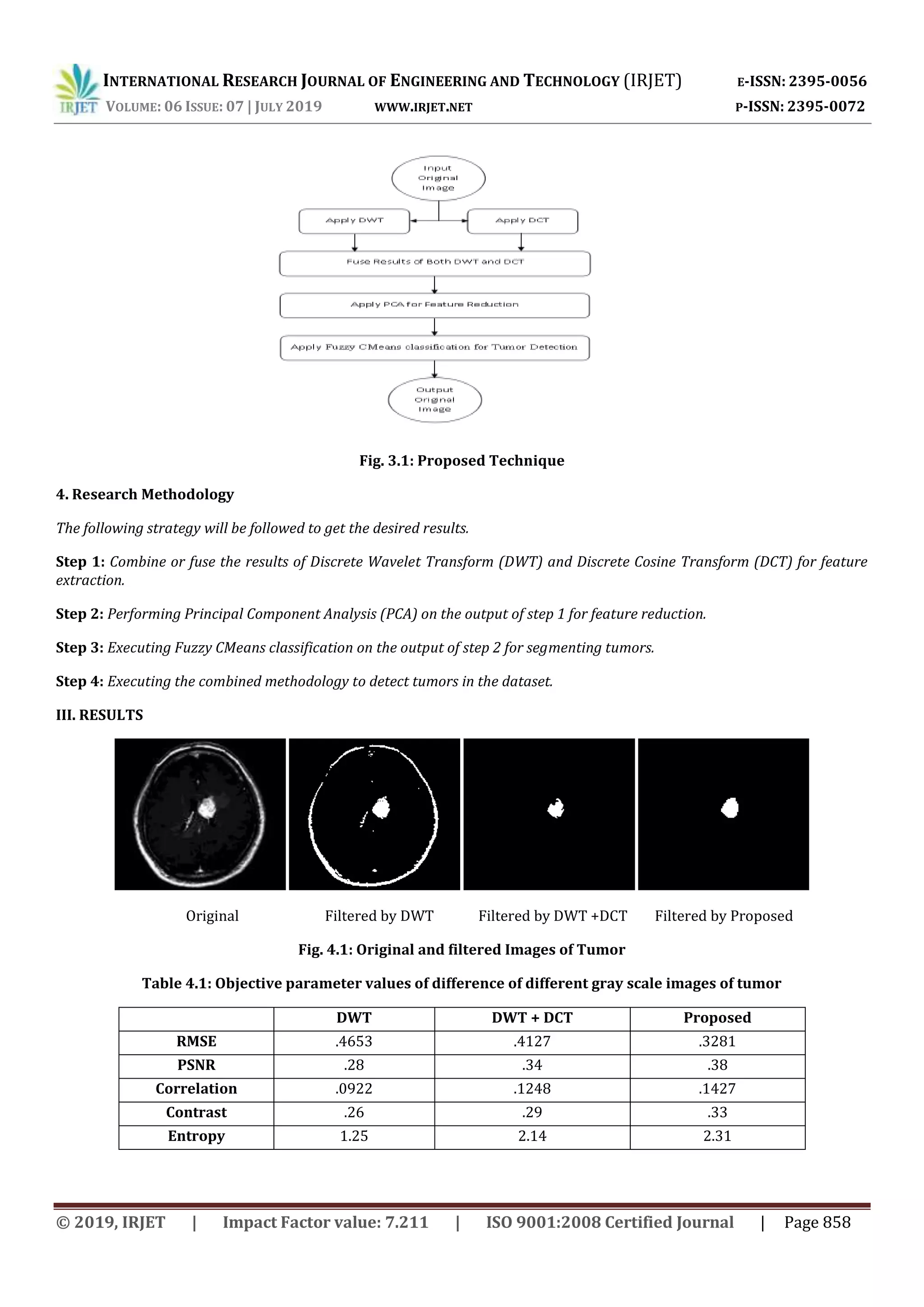 IRJET- Brain Tumor Detection using Hybrid Model of DCT DWT and Thresholding | PDF