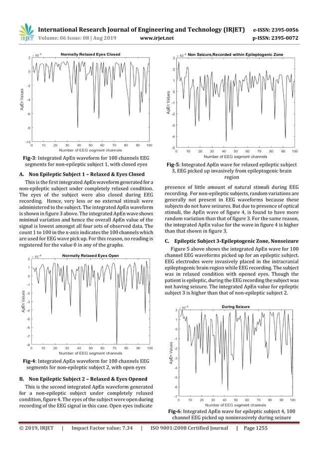 IRJET- Analysis of Epilepsy using Approximate Entropy Algorithm | PDF