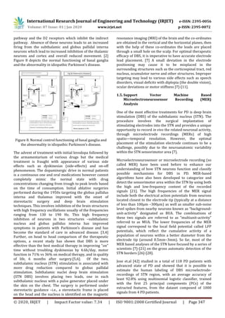 IRJET- Precision of Lead-Point with Support Vector Machine based ...
