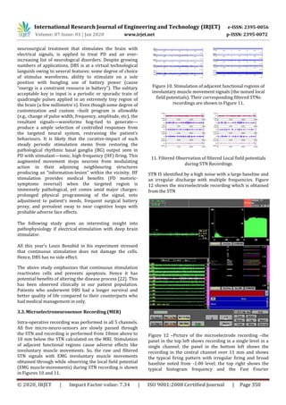 IRJET- Precision of Lead-Point with Support Vector Machine based Microelectroneurosensor ...