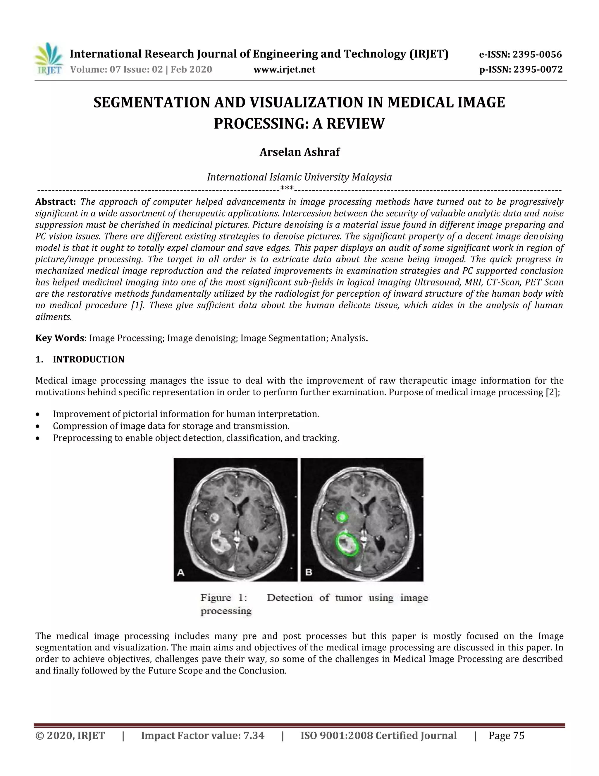 IRJET- Segmentation and Visualization in Medical Image Processing: A Review | PDF | Photo ...