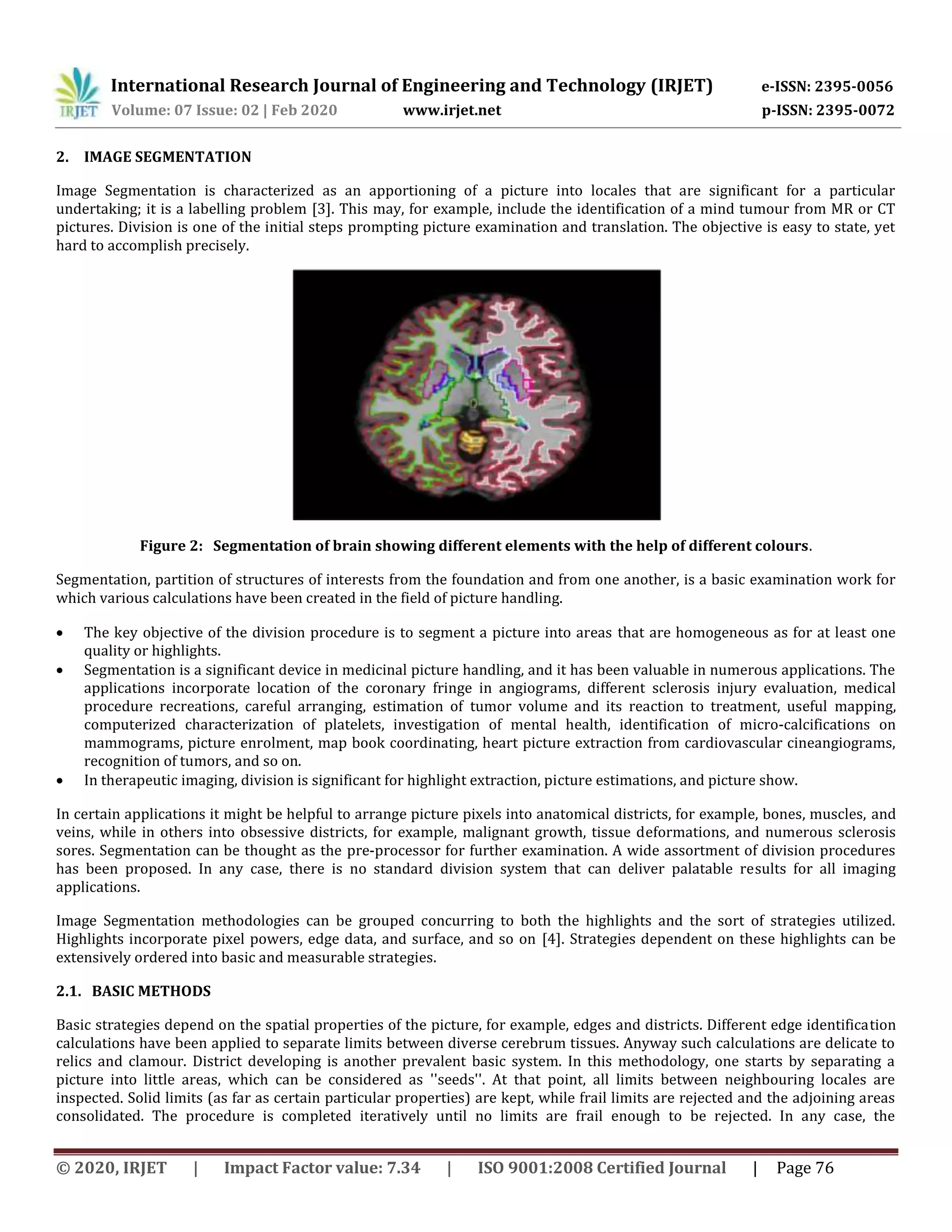 IRJET- Segmentation and Visualization in Medical Image Processing: A Review | PDF | Photo ...