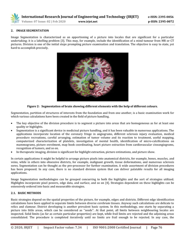 IRJET- Segmentation and Visualization in Medical Image Processing: A Review | PDF | Photo ...