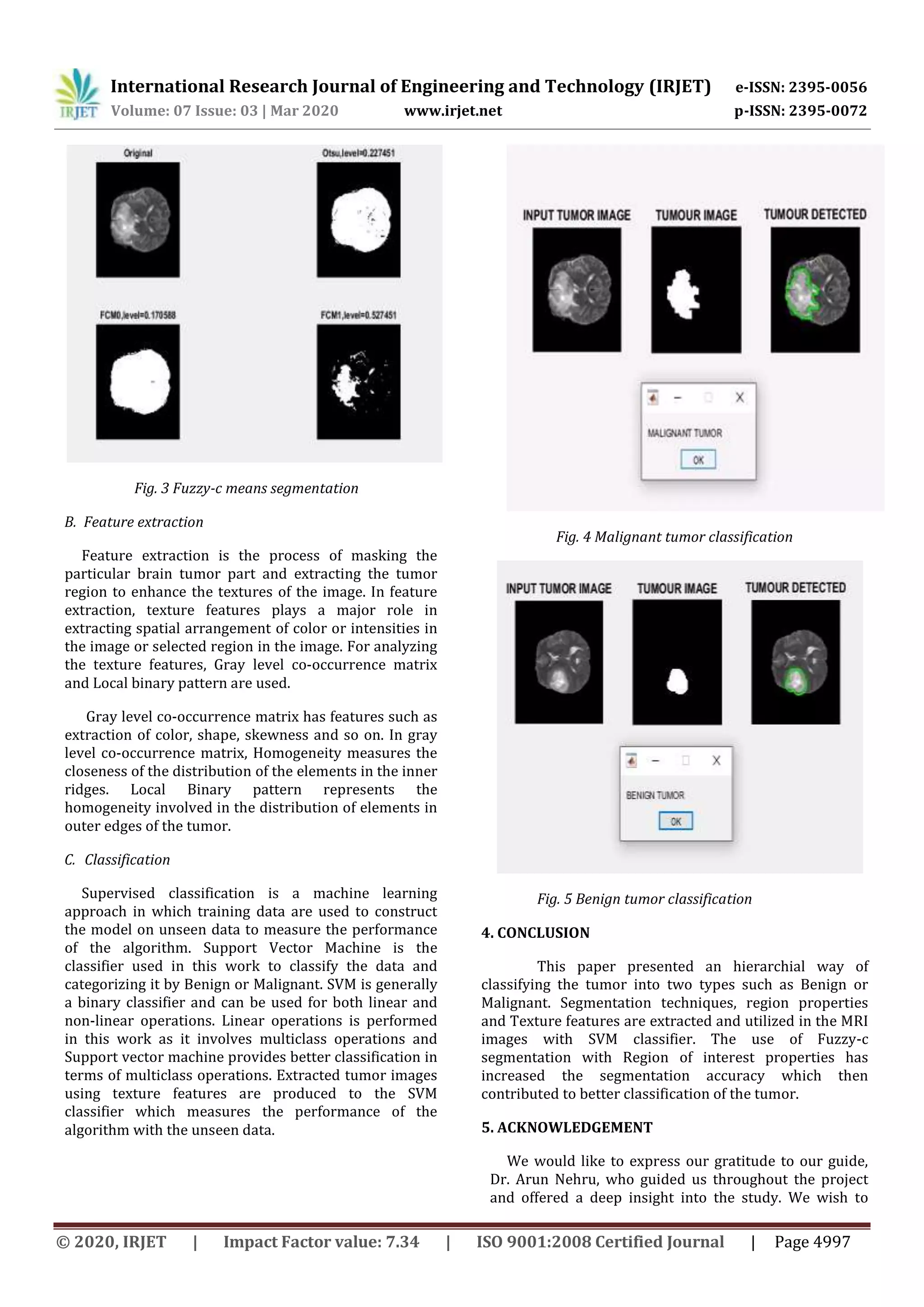 IRJET - An Efficient Approach for Multi-Modal Brain Tumor Classification using Texture Features ...