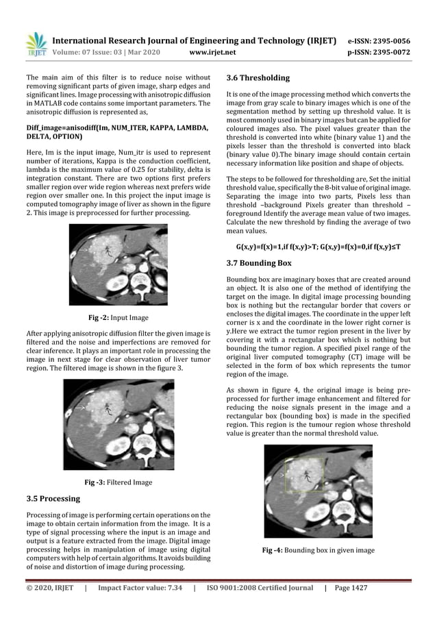 IRJET - Liver Cancer Detection using Image Processing | PDF