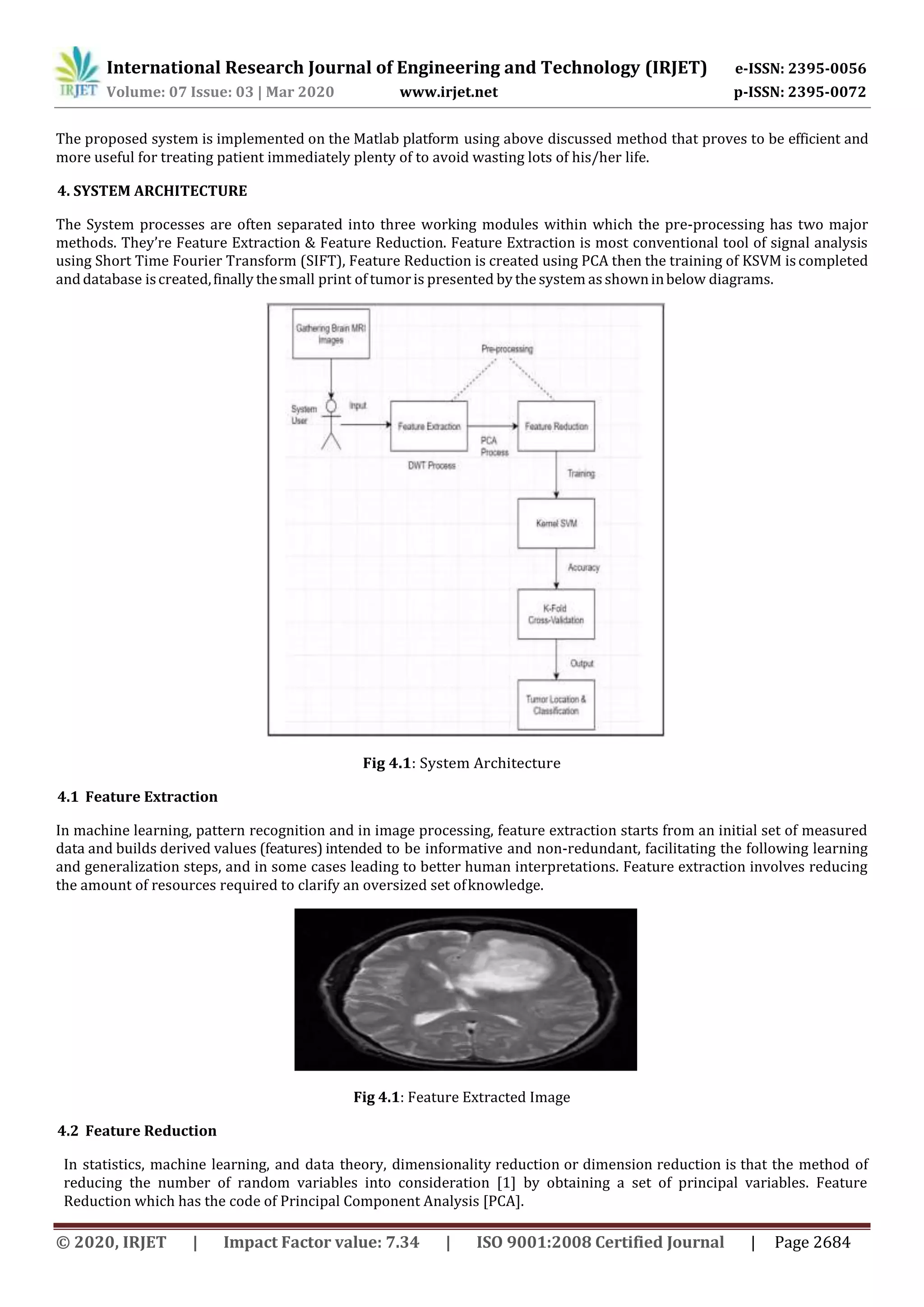 IRJET - Detection and Classification of Brain Tumor | PDF | Brain and Nervous System Disorders ...