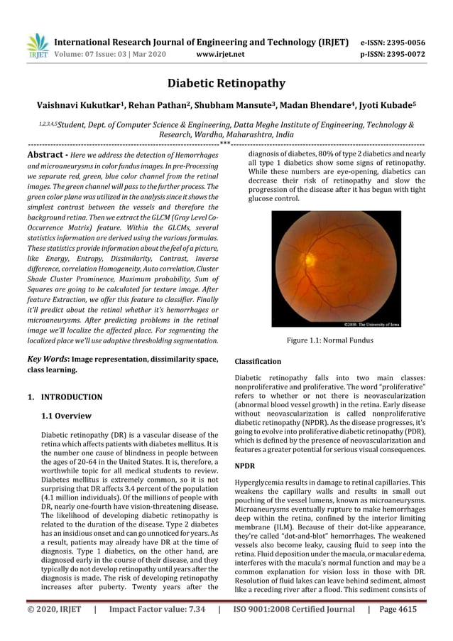 IRJET - Diabetic Retinopathy | PDF