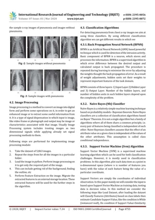 IRJET - Detecting Pneumonia from Chest X-Ray Images using Committee Machine | PDF | Lung and ...