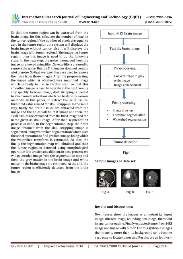 Irjet Detection Of Brain Tumor From Mri Images Using Matlab Pdf
