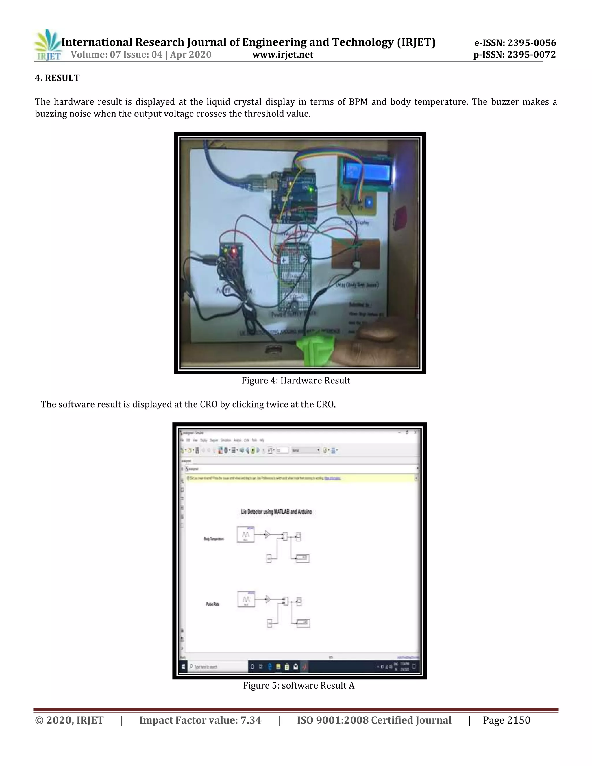 IRJET - Simulink based Real Time Blood Pressure and Body Tempraure Monitring System | PDF ...
