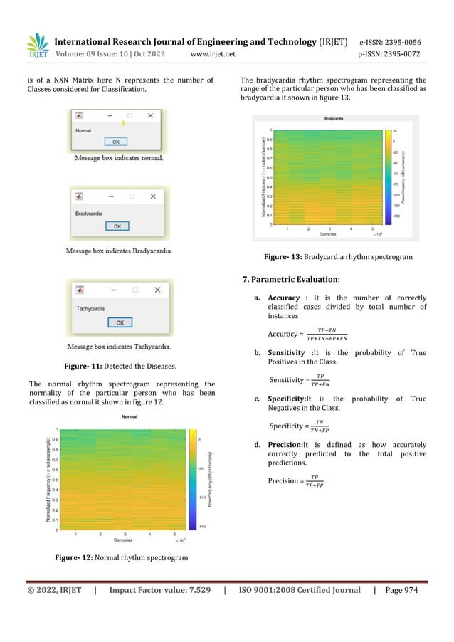 DIAGNOSIS OF BRADYCARDIA ARRHYTHMIA USING MEMD AND CONVOLUTIONAL NEURAL NETWORKS | PDF | Heart ...