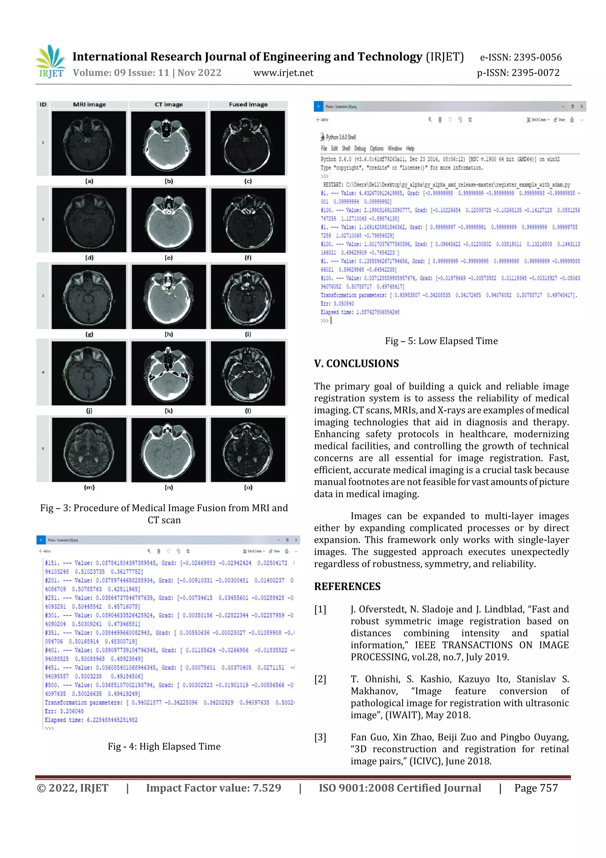 DEVELOPMENT OF FAST AND ROBUST IMAGE REGISTRATION METHOD USING DISTANCE MEASURES FOR IMPROVED ...
