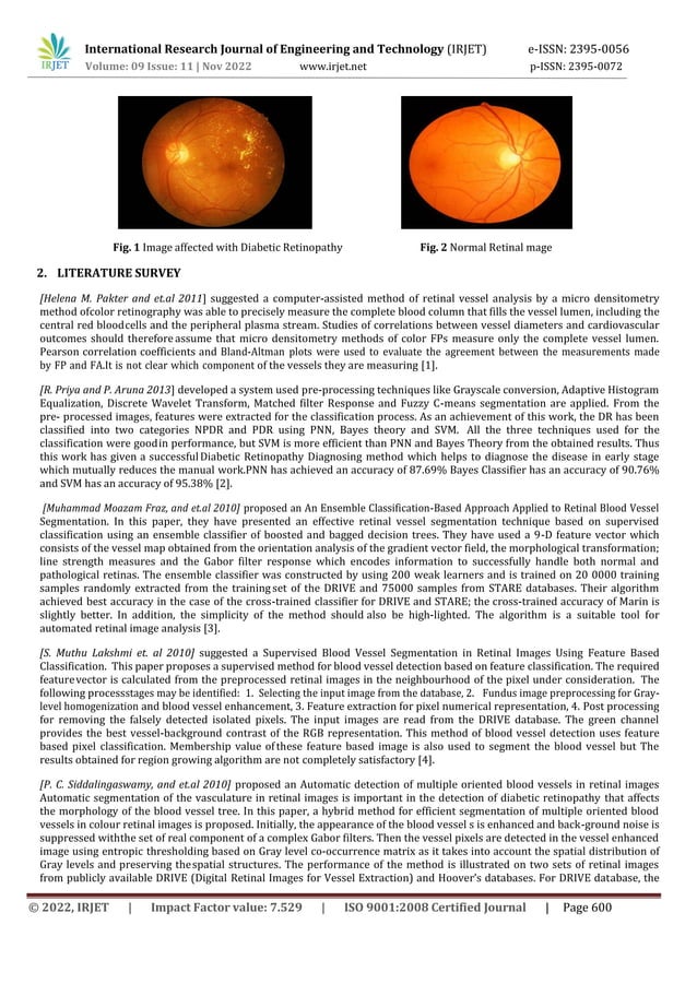Feature Extraction To Detect And Classify Diabetic Retinopathy Using Fundal Images Pdf