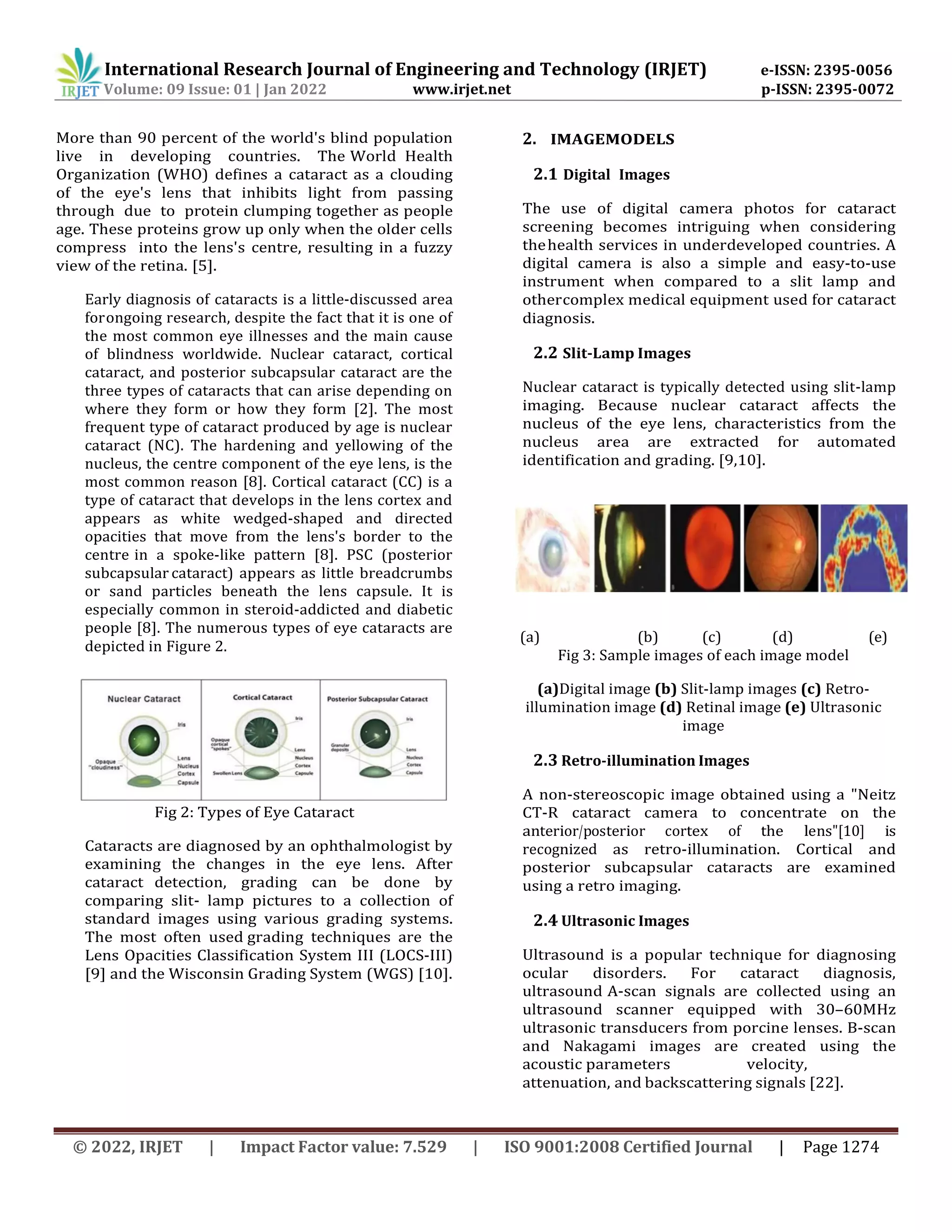 Cataract Disease Detection And Classification Using Retinal Image Model