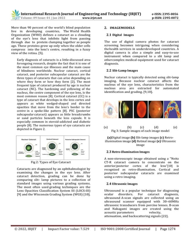 Cataract Disease Detection And Classification Using Retinal Image Model