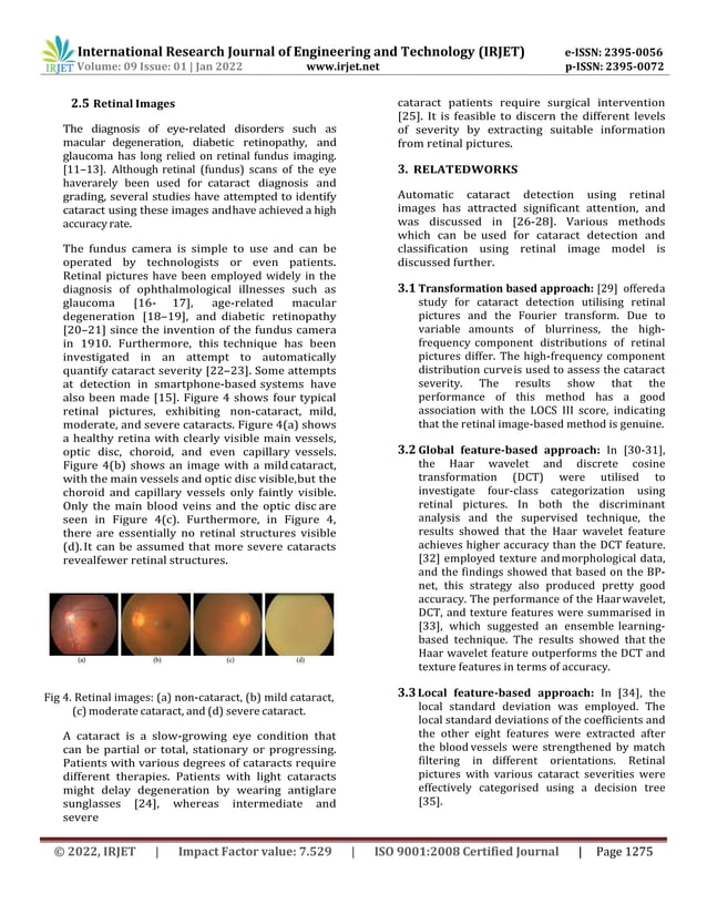 Cataract Disease Detection And Classification Using Retinal Image Model