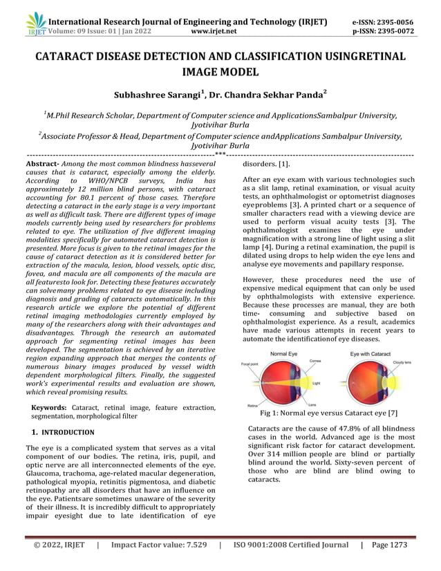 Cataract Disease Detection And Classification Using Retinal Image Model