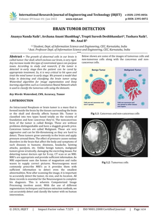 BRAIN TUMOR DETECTION | PDF