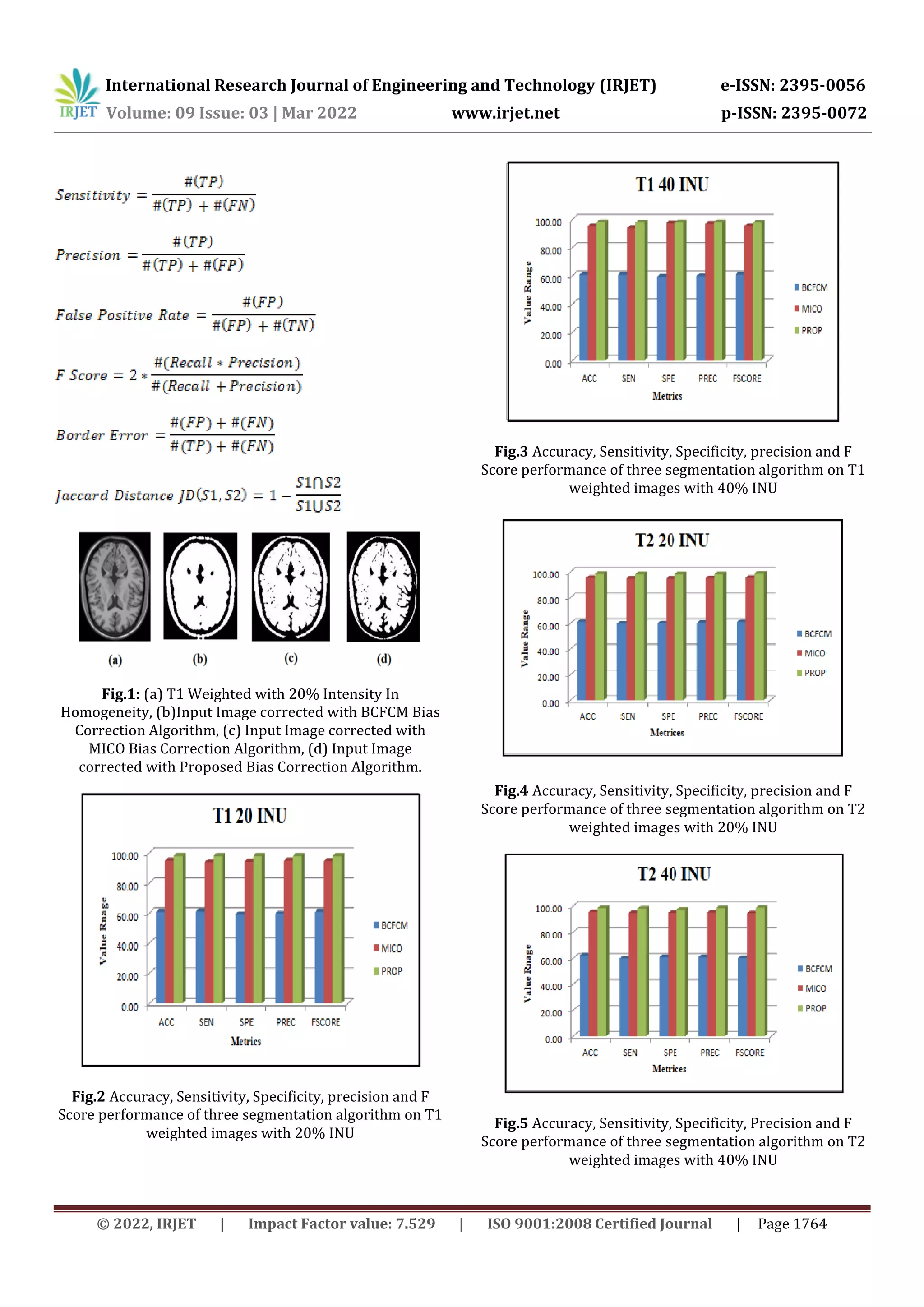 Precise Foreground Extraction Bias Correction And Segmentation Of