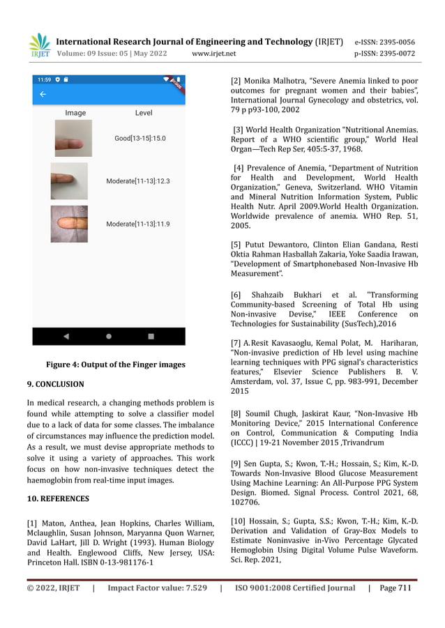 Bloodless Haemoglobin level Detection using Deep Convolution Neural Network | PDF