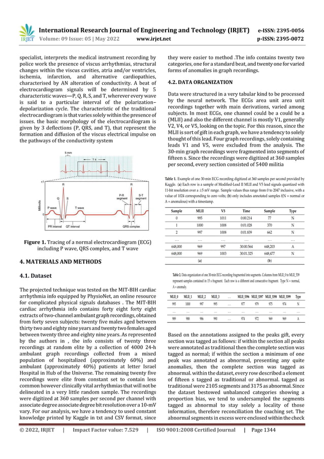 APPLICATION OF 1D CNN IN ECG CLASSIFICATION | PDF