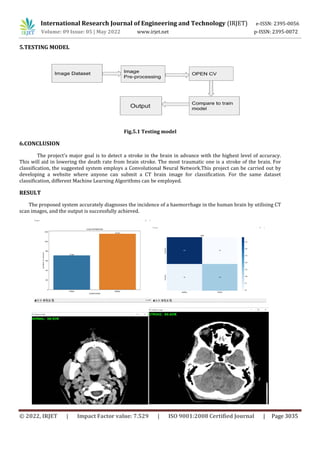 DEEP LEARNING BASED BRAIN STROKE DETECTION | PDF