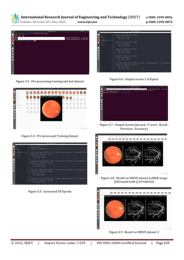 Retinal Vessel Segmentation in U-Net Using Deep Learning | PDF