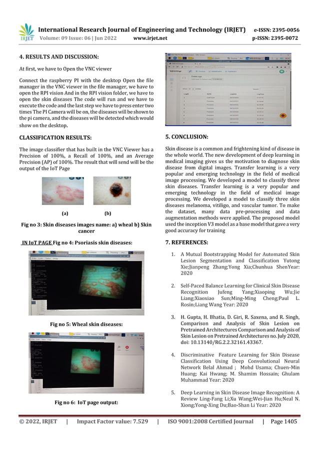 DETECTION OF DIFFERENT TYPES OF SKIN DISEASES USING RASPBERRY PI | PDF ...