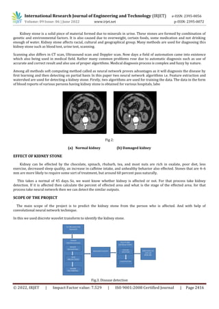Detection of Kidney Stone using Neural Network Classifier | PDF